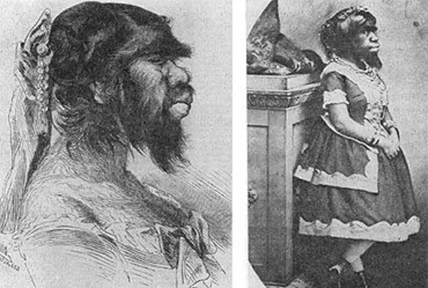 Волосатые люди и их судьба - ПолонСил.ру - социальная сеть здоровья ...